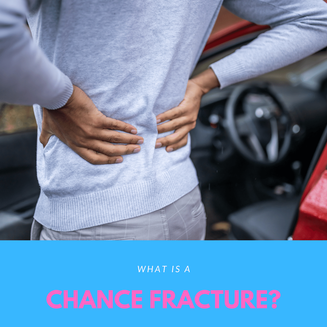 What Is A Chance Fracture? | New Jersey | Comprehensive Spine Care