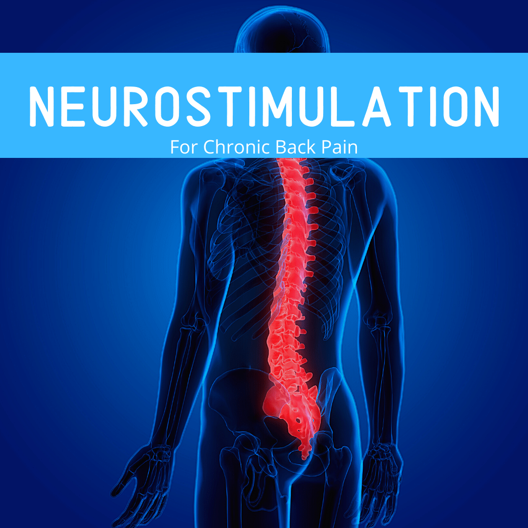 Neurostimulation For Chronic Back Pain | New Jersey | Comprehensive ...