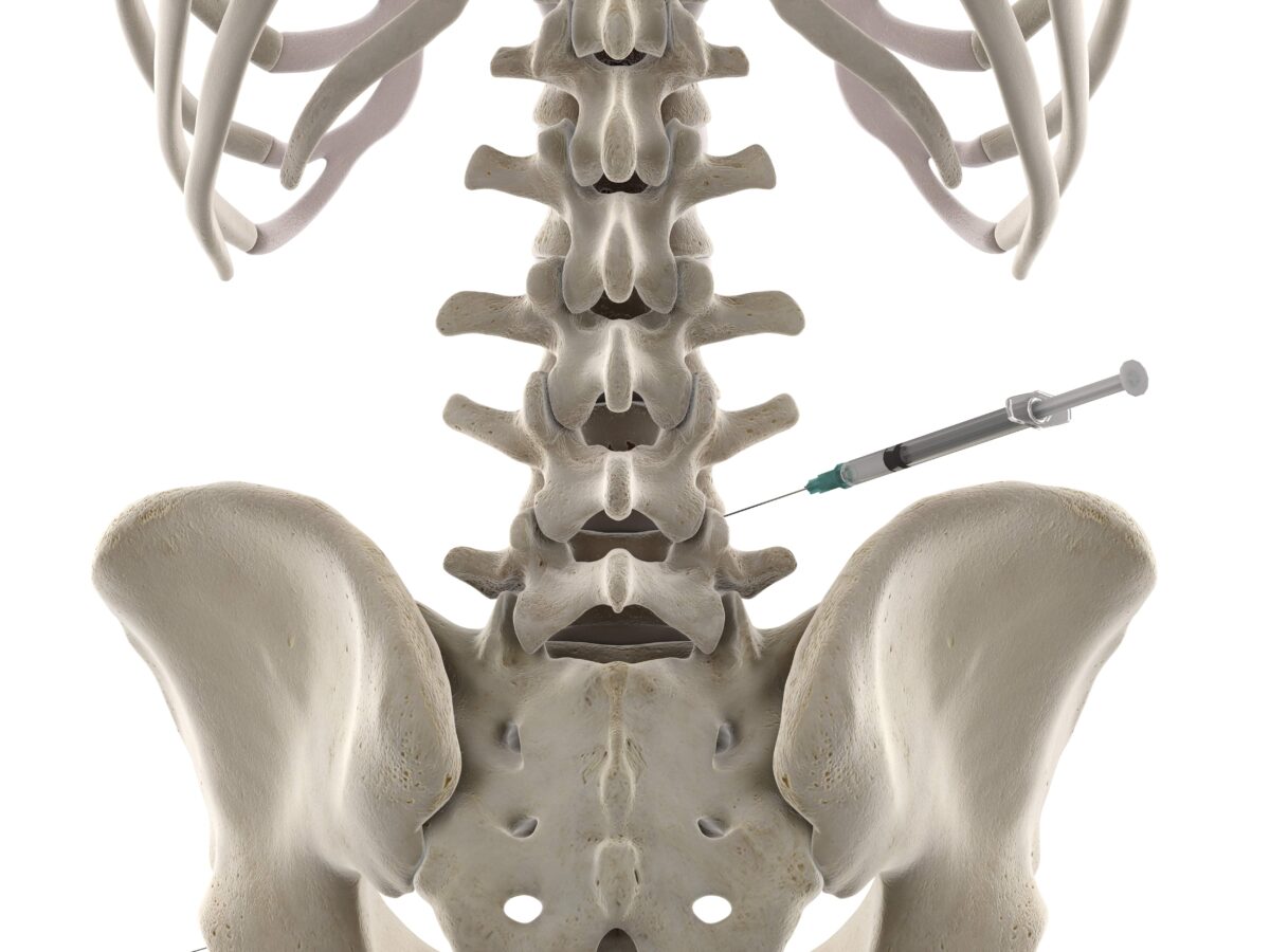 What Is An Intradiscal Injection? | New Jersey | Comprehensive Spine Care