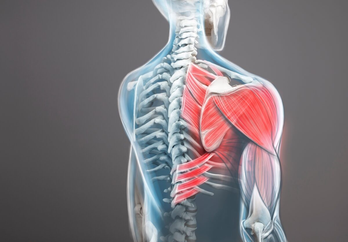 7 Reasons For Back Pain Around The Shoulders | New Jersey ...