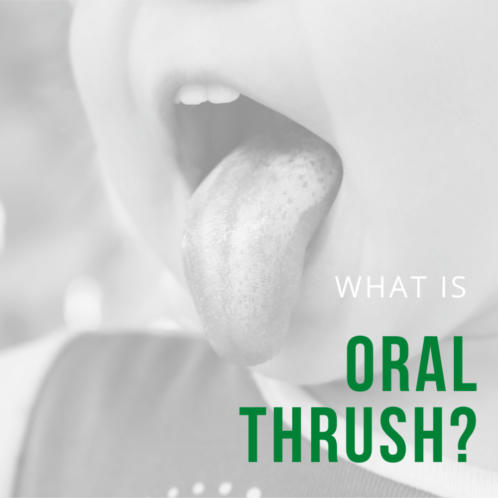 What Is Oral Thrush? | Acorn Dentistry For Kids
