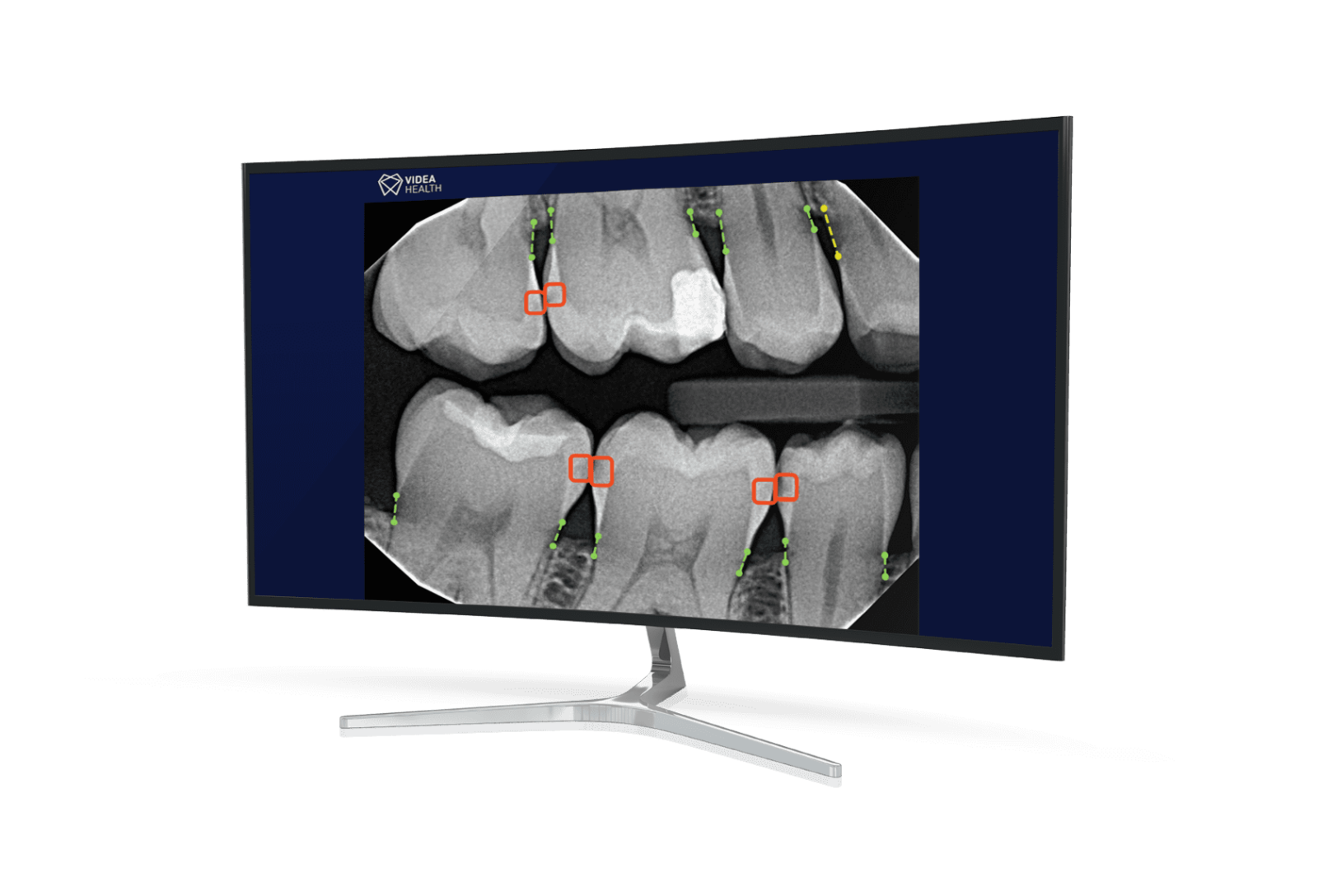 Artificial Intelligence in Dentistry | Artisan Dental in Madison, WI Artificial Intelligence in Dentistry | Artisan Dental in Madison, WI