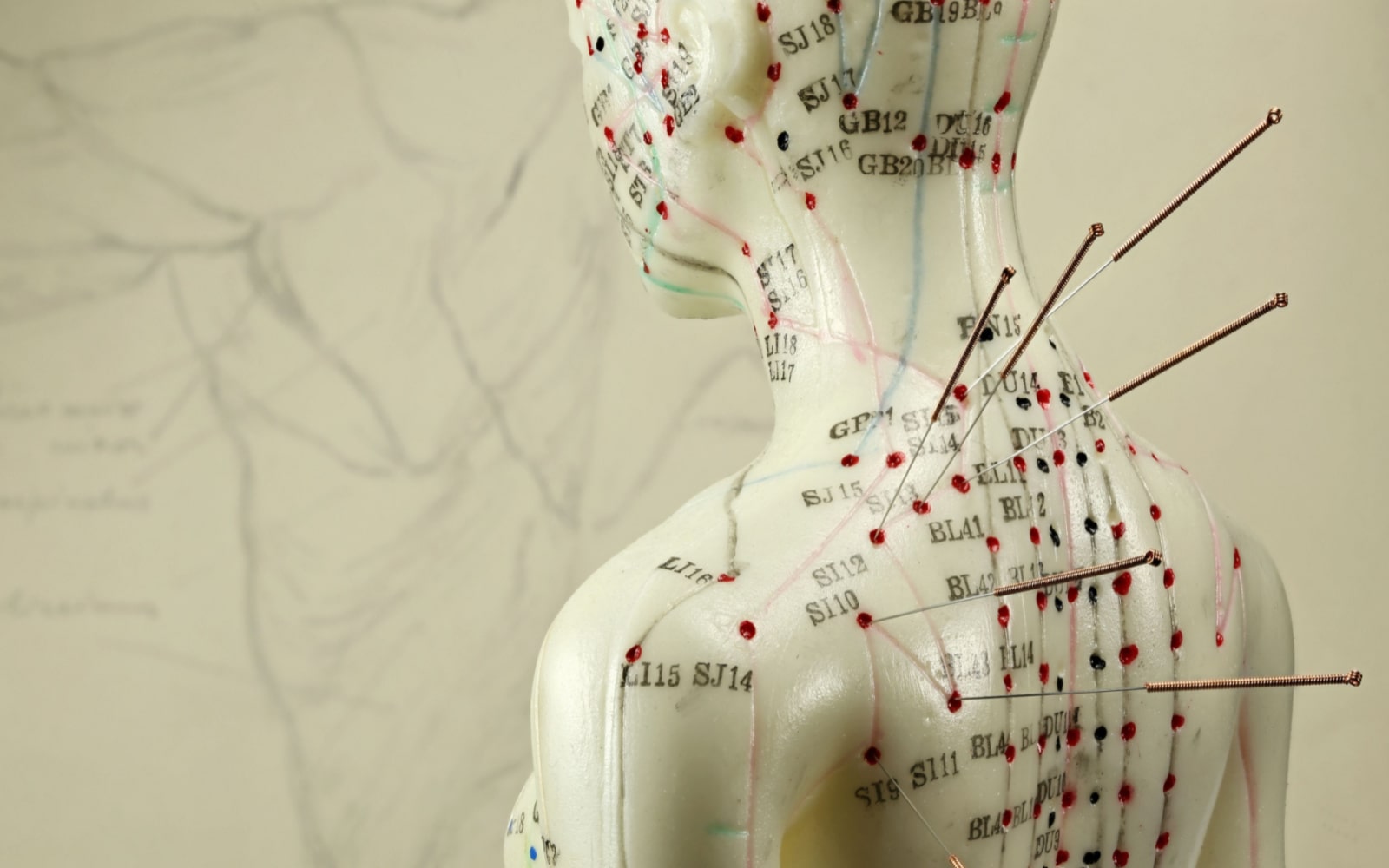 The history of acupuncture in modern medicine | Alternative Health ...