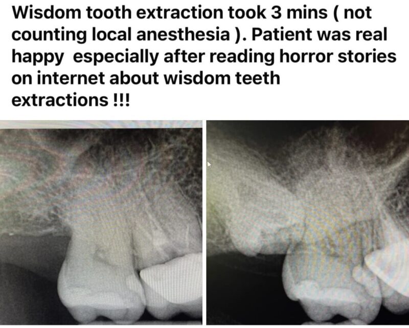 Gallery • Wheeling Dentistry • Illinois