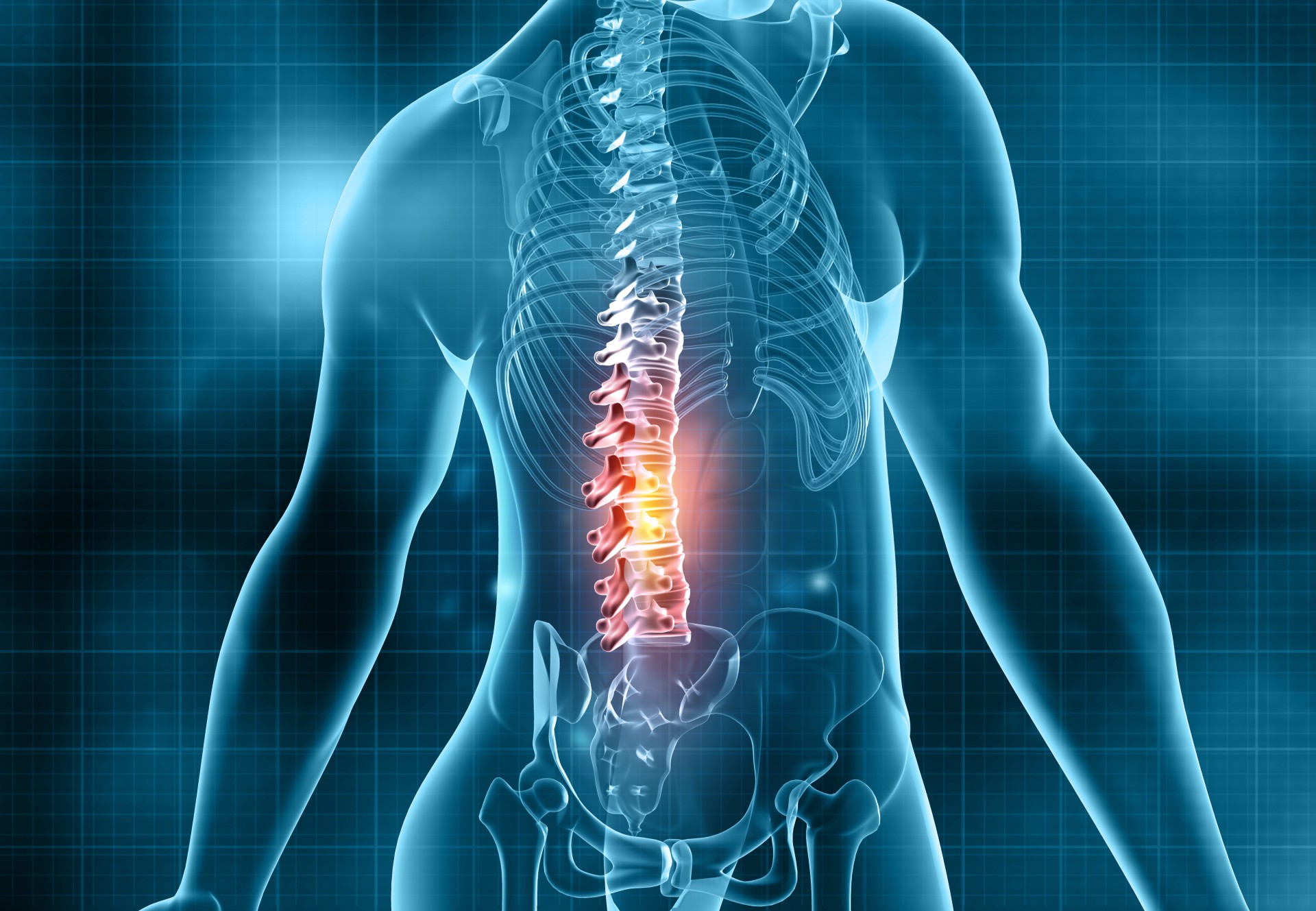 Spinal Cord Stimulation (Neuromodulation) • Trusha Shah, MD