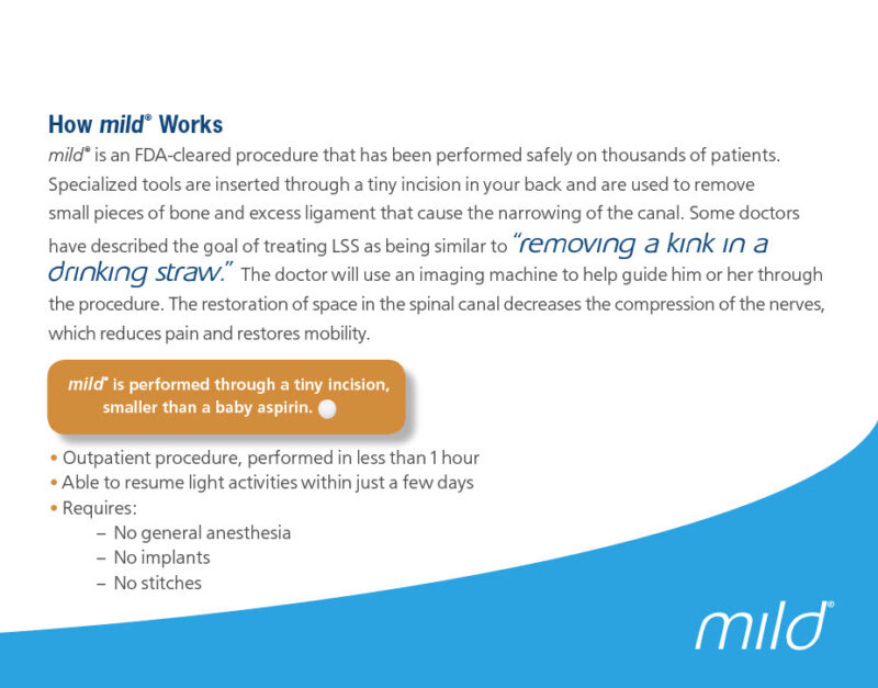 MILD Procedure • Trusha Shah, MD