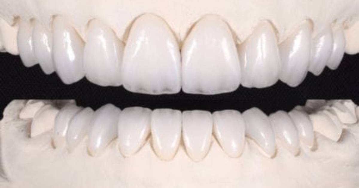 Hex Dental Lab - Creating Smiles with Style