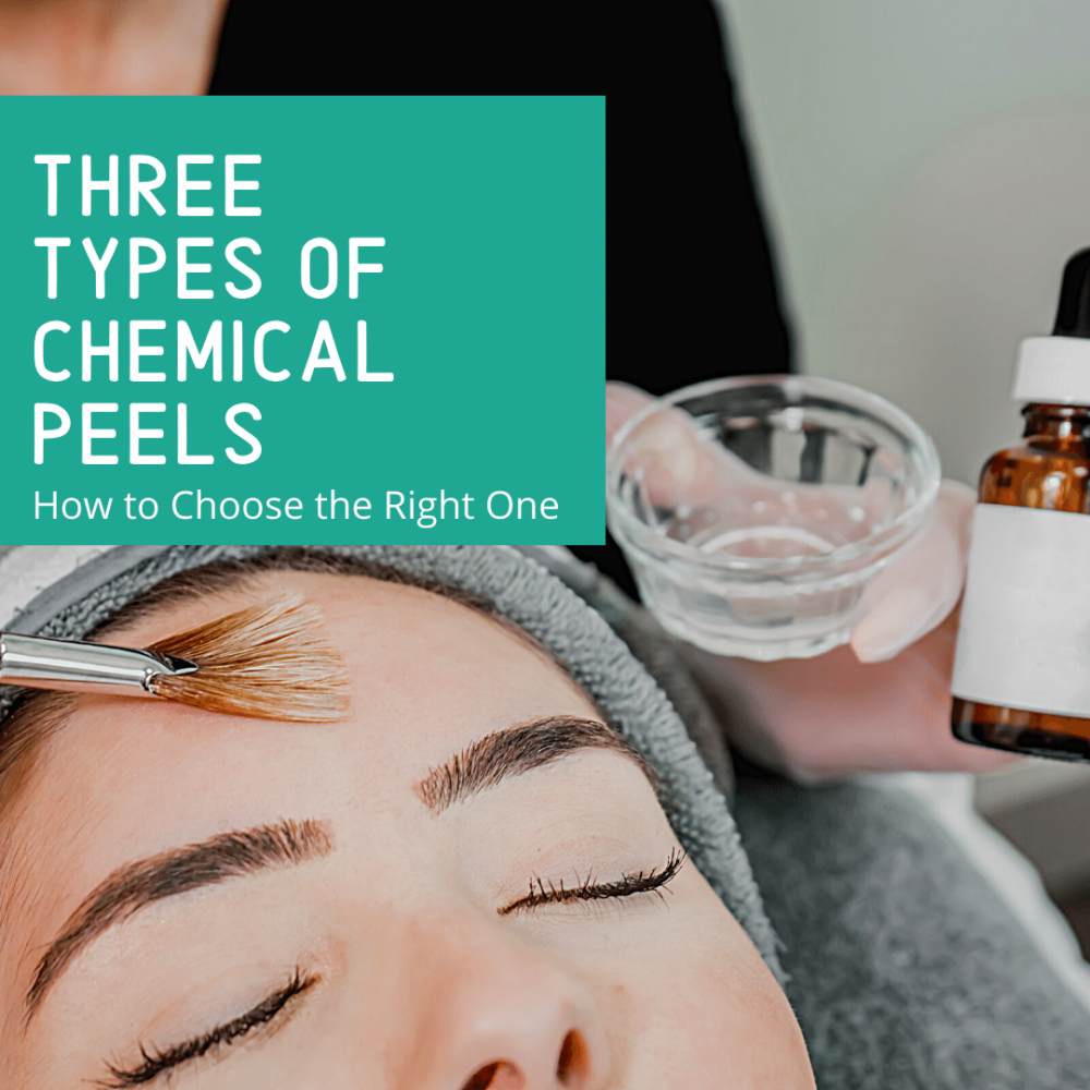 Three Types of Chemical Peels: How to Choose the Right One | Annapolis ...