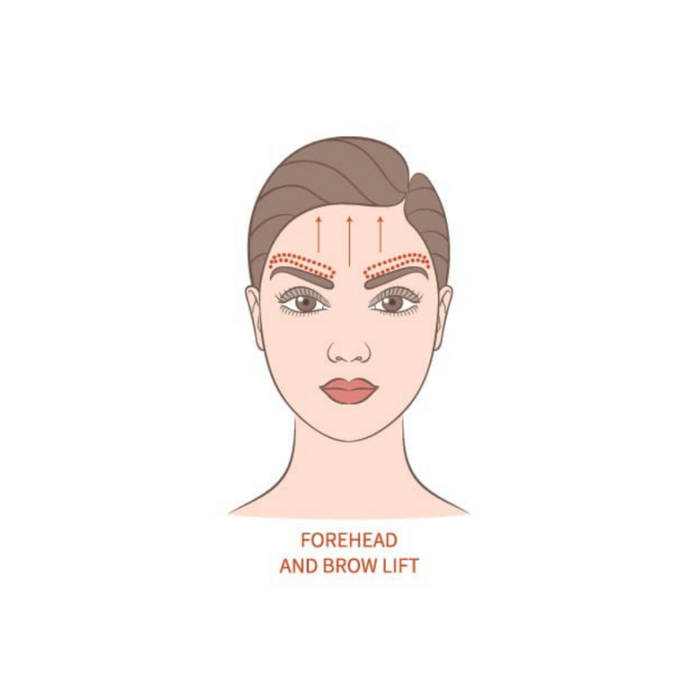 The Differences Between Eyelid Surgery and Brow Lift | Annapolis and ...