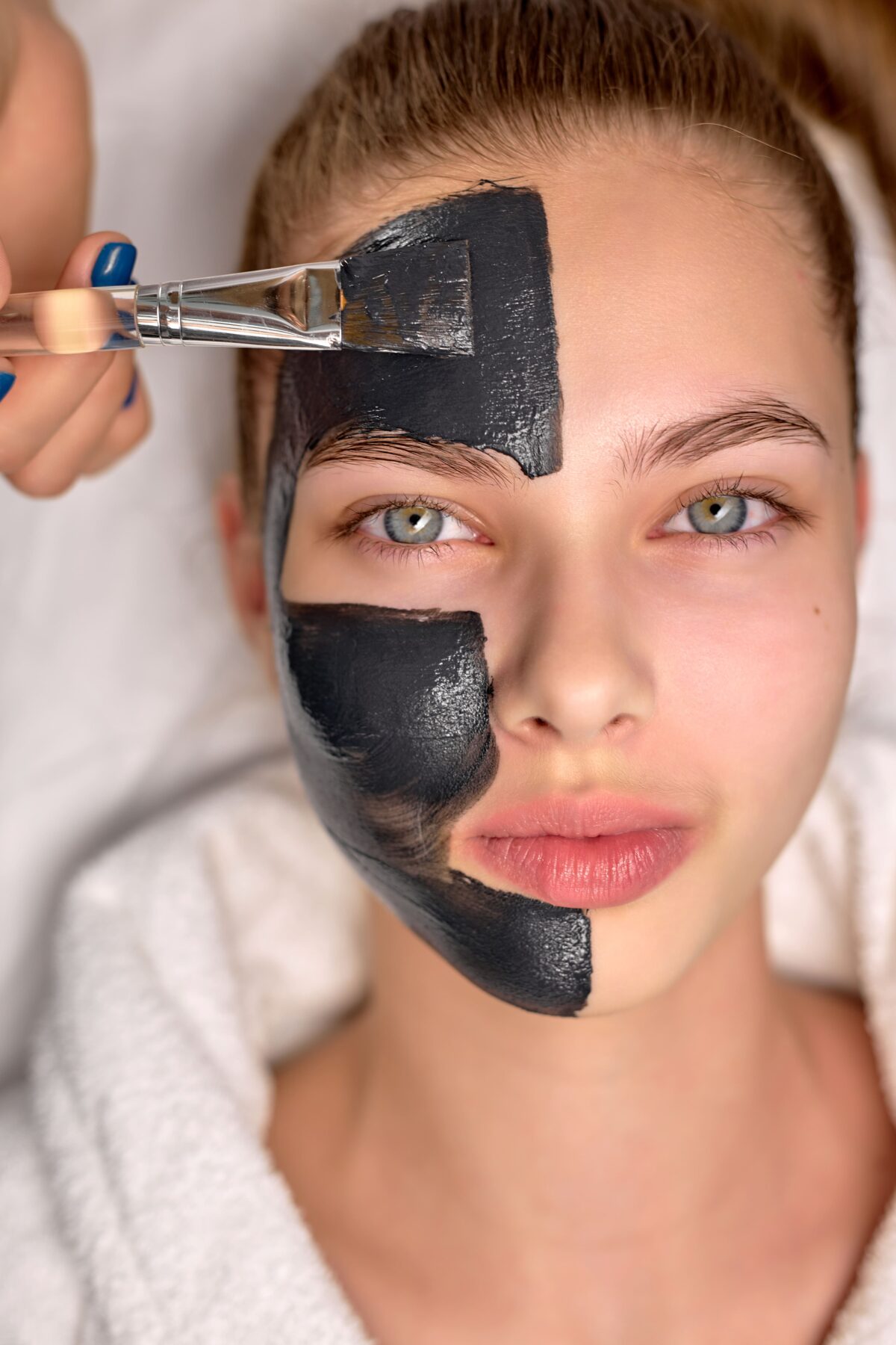 The Top 5 Treatments to Get Rid of Blackheads | Annapolis and Severna ...