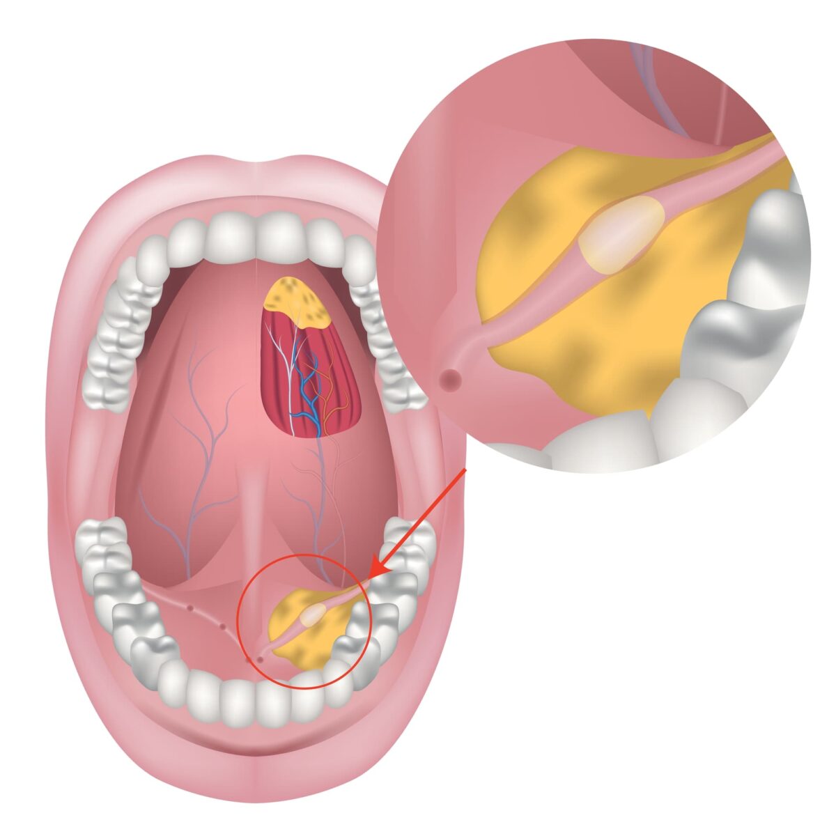 What You Need to Know About Salivary Gland Disorders | Annapolis and ...