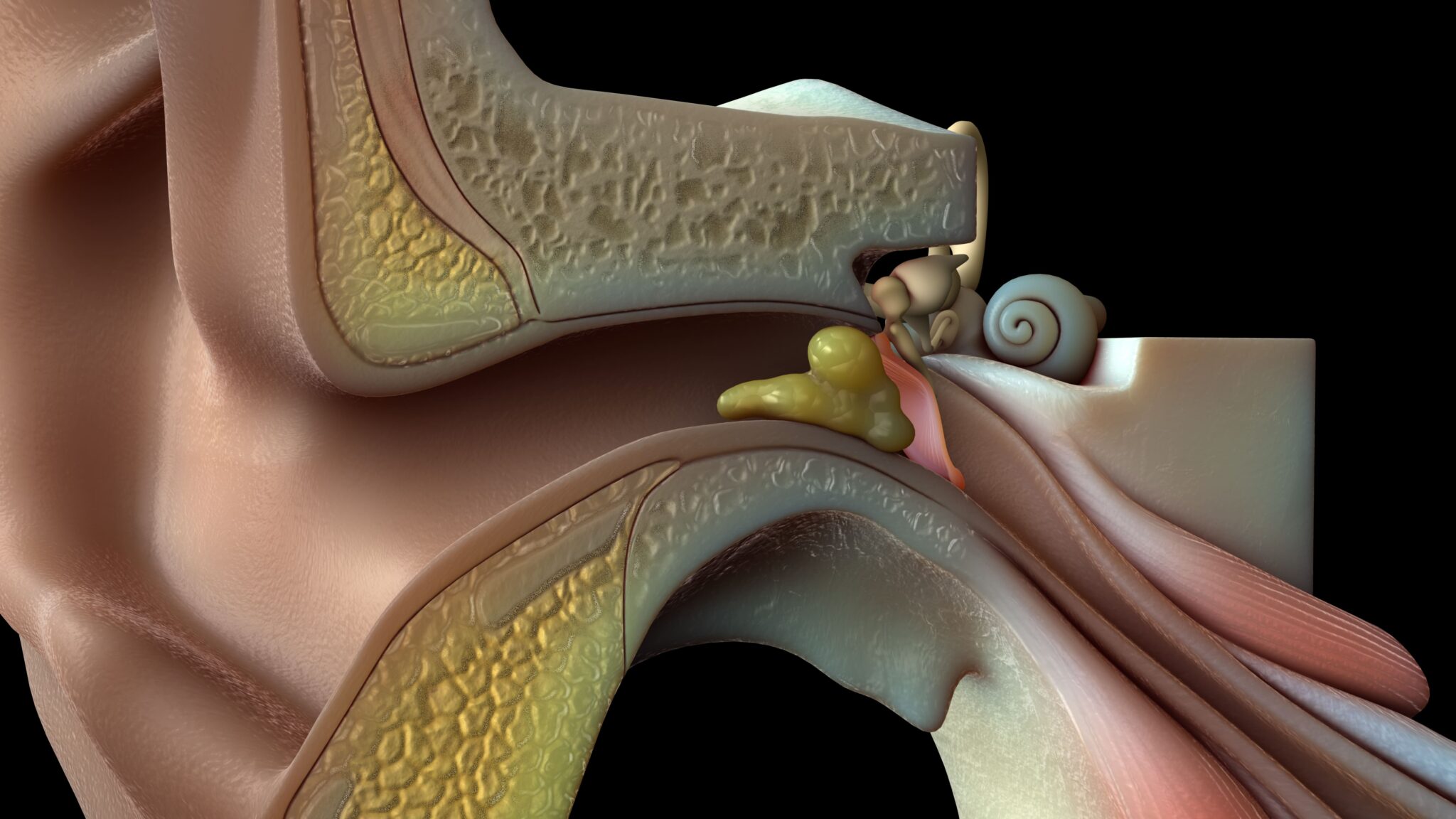 Safely Removing Ear Wax: Expert Advice from an ENT Doctor | Annapolis ...