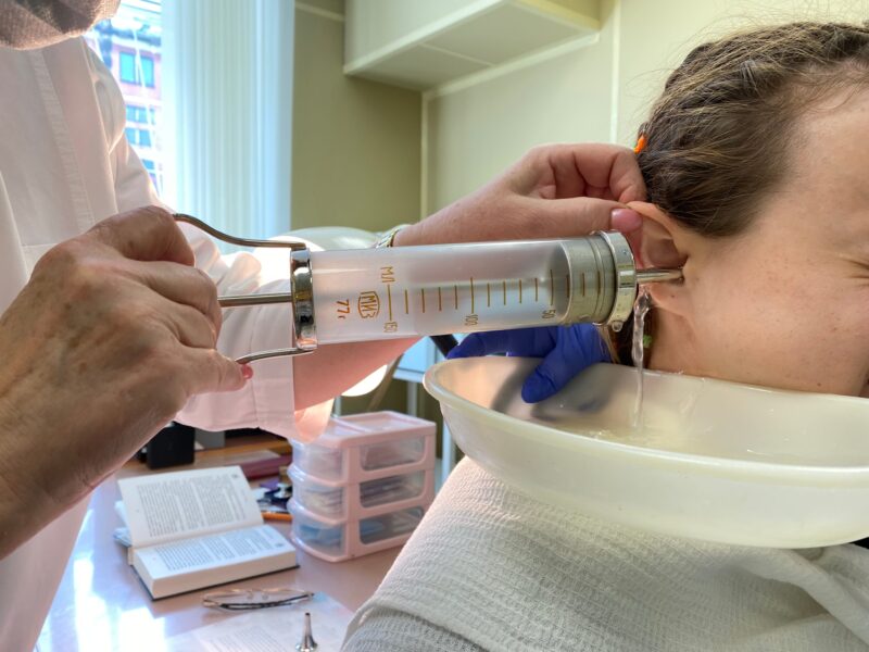 Safely Removing Ear Wax: Expert Advice from an ENT Doctor | Annapolis ...