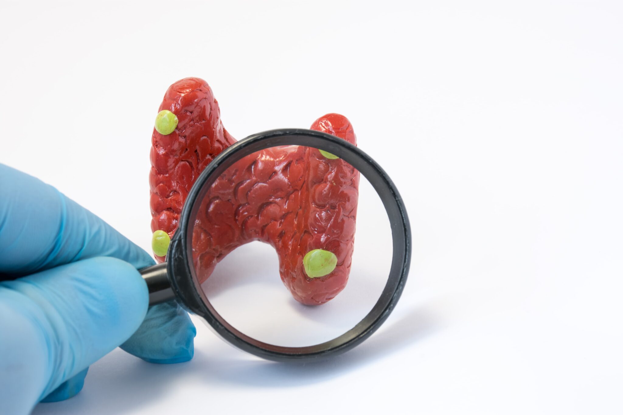 Parathyroid vs. Thyroid Gland: What's the Difference? | Annapolis and Severna Park, MD