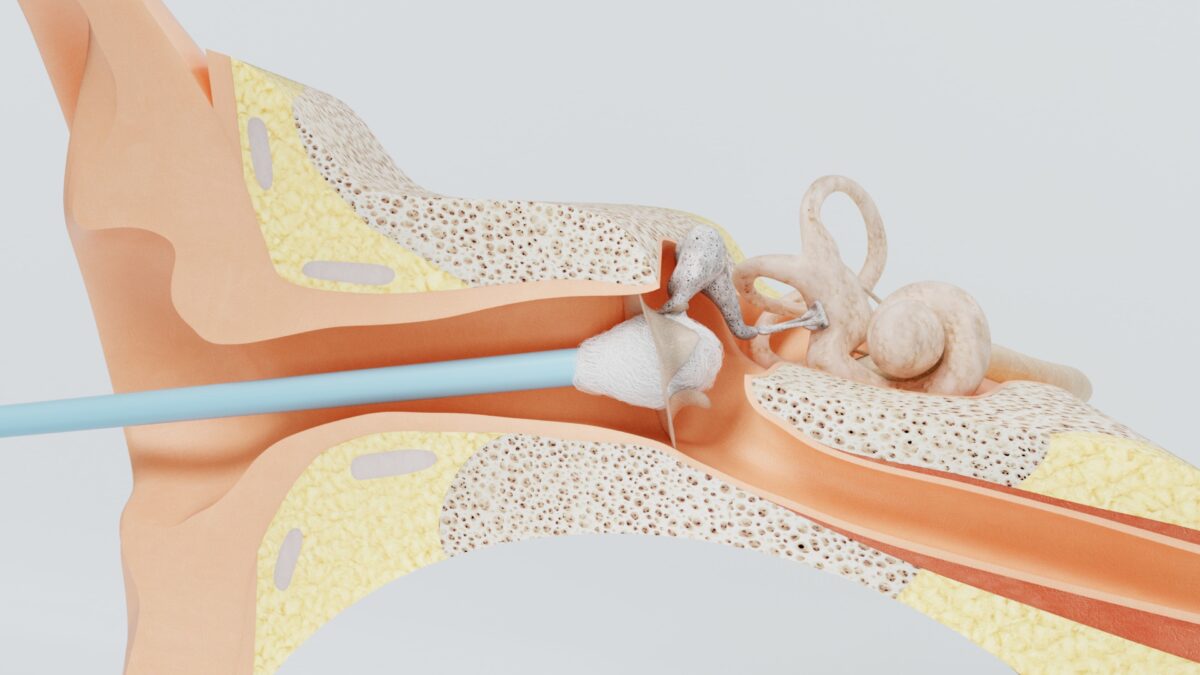 What Causes Your Eardrum to Rupture? | Annapolis and Severna Park, MD