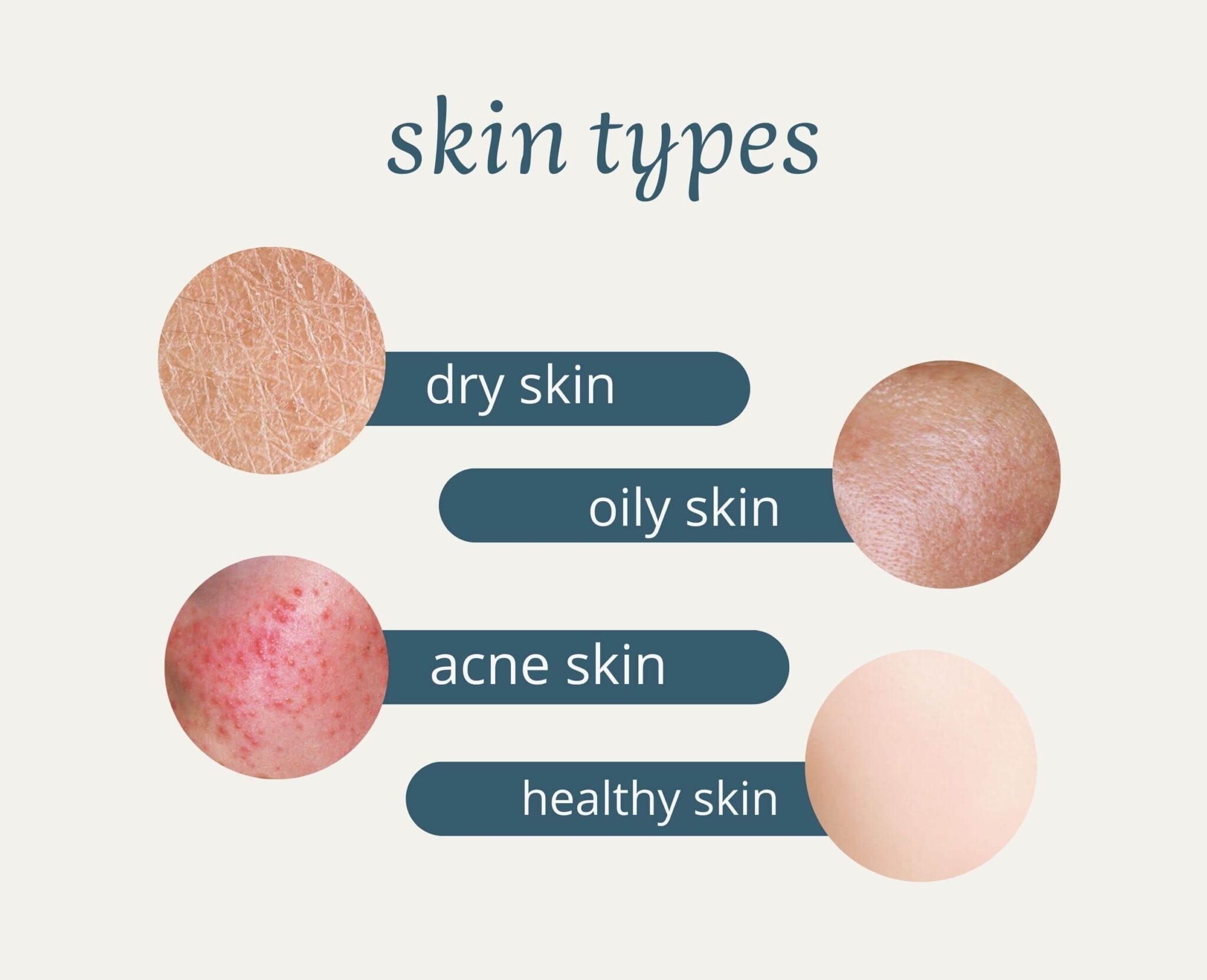 Choosing the Perfect Facial for Your Skin Type | Annapolis and Severna ...