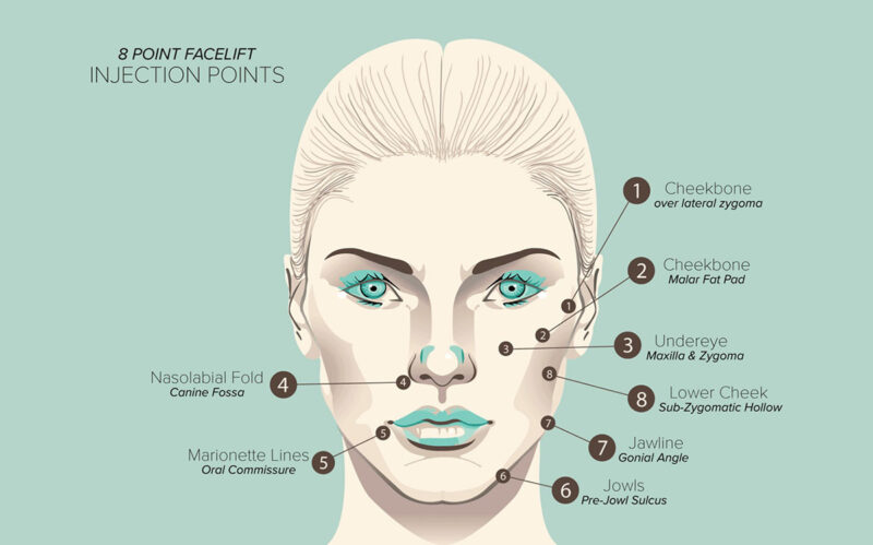 8 Point Liquid Skinlifting • Junglinster, Luxembourg • Advance Aesthetics