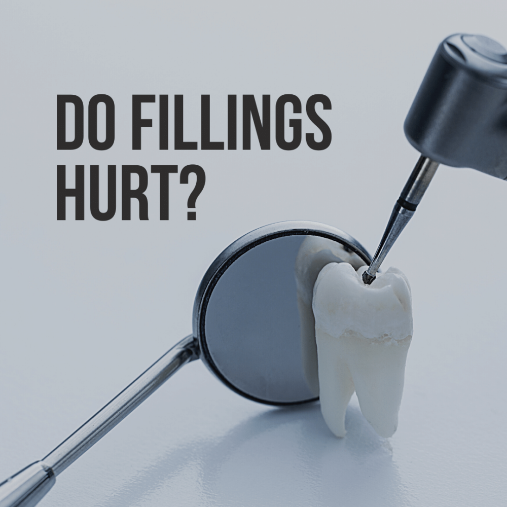 Do Fillings Hurt? | McLean, VA | Smile Mclean Dentistry