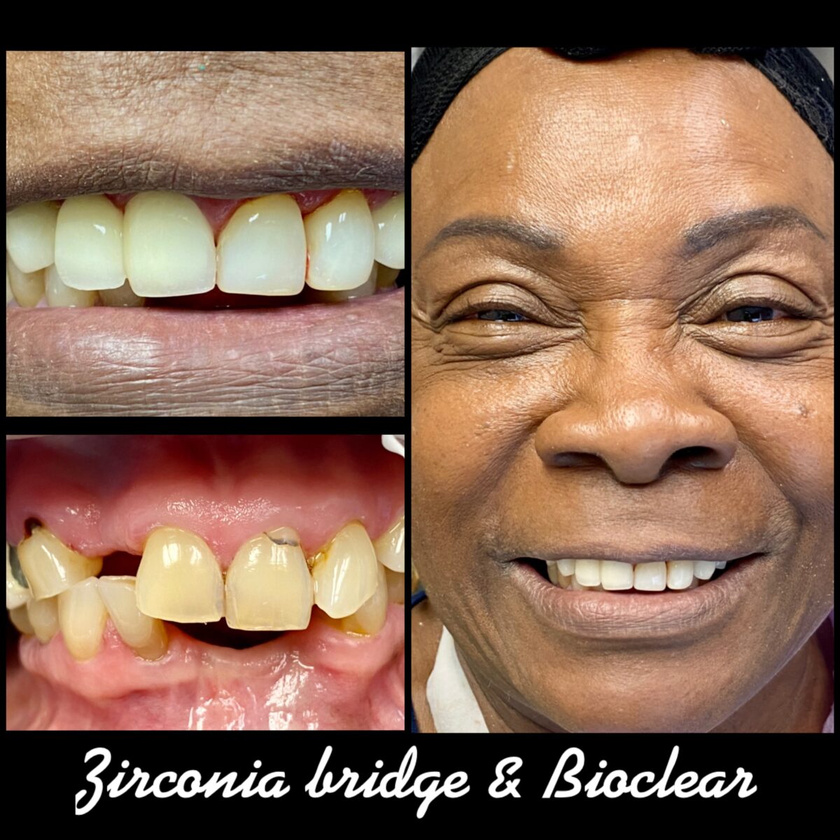 Smile Gallery | Laser Dental Bakersfield