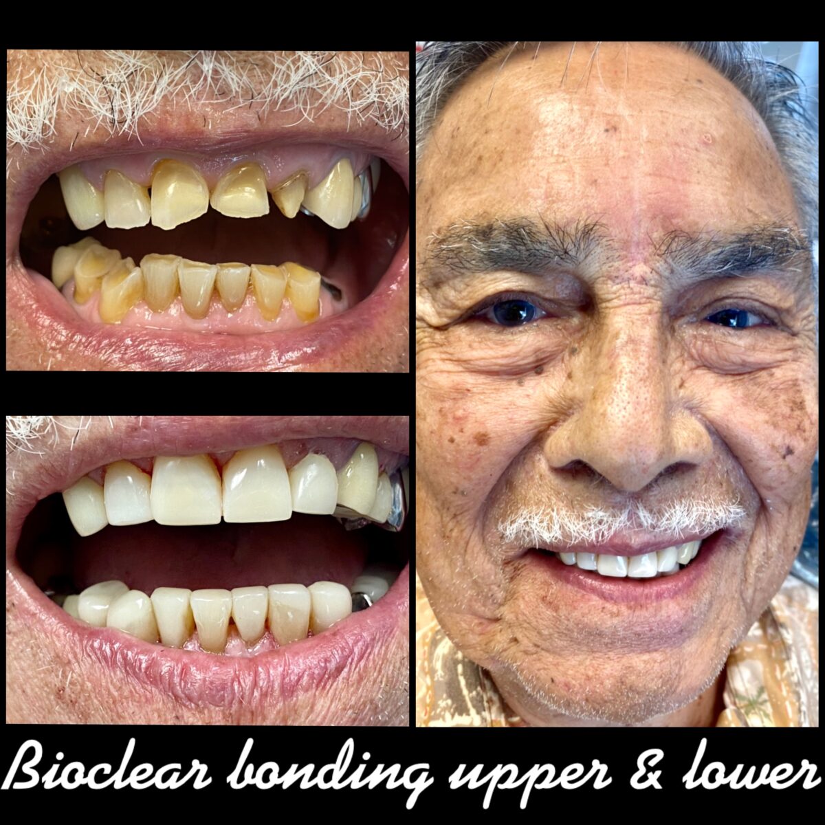 Smile Gallery | Laser Dental Bakersfield