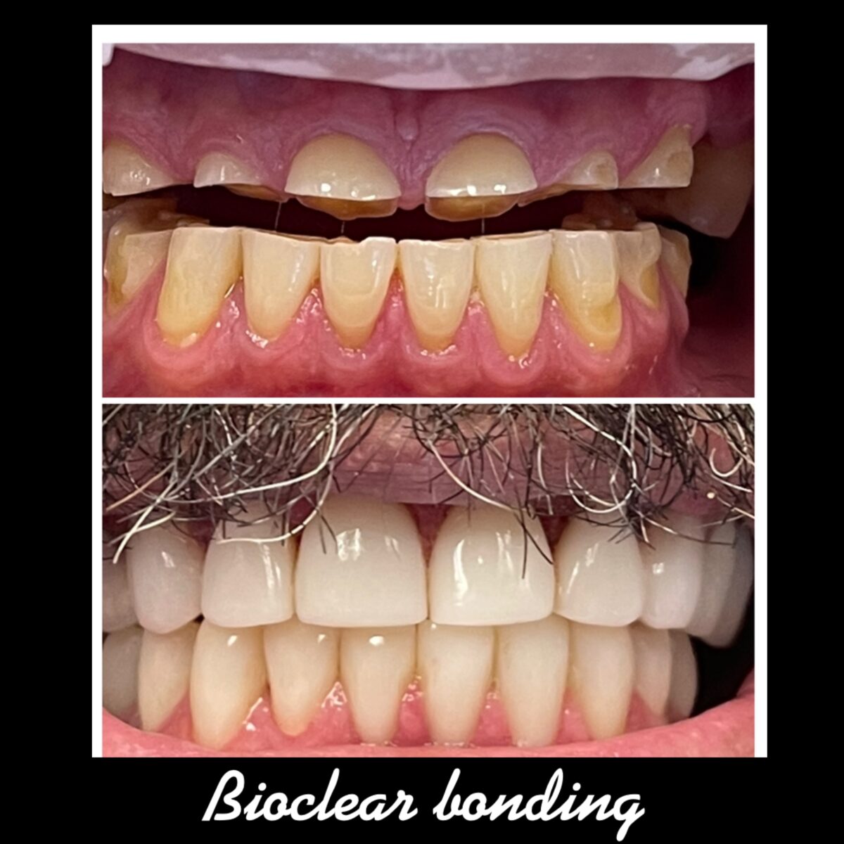 Smile Gallery | Laser Dental Bakersfield