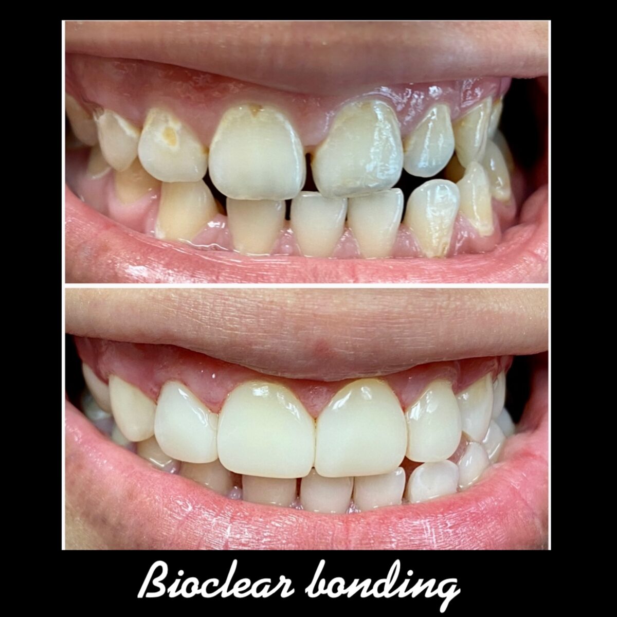 Smile Gallery | Laser Dental Bakersfield