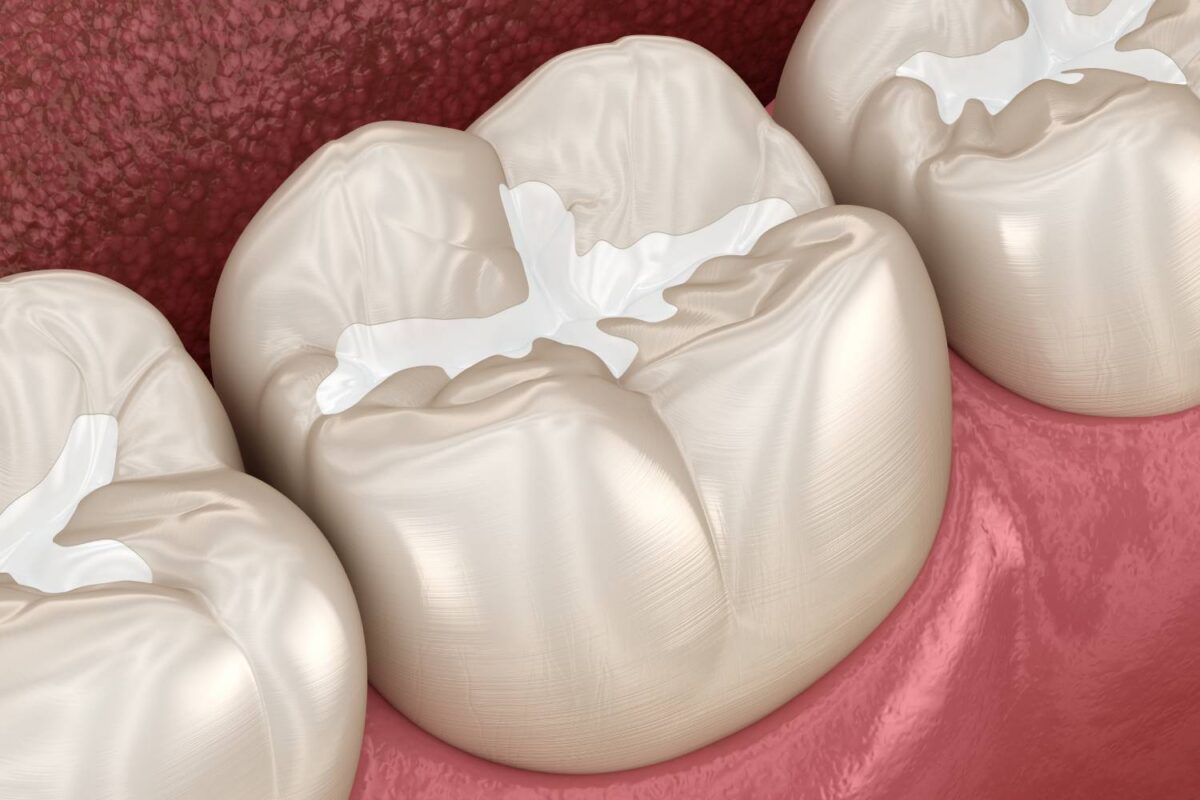 South Hill Comprehensive Dentistry | Dentist in Spokane, WA