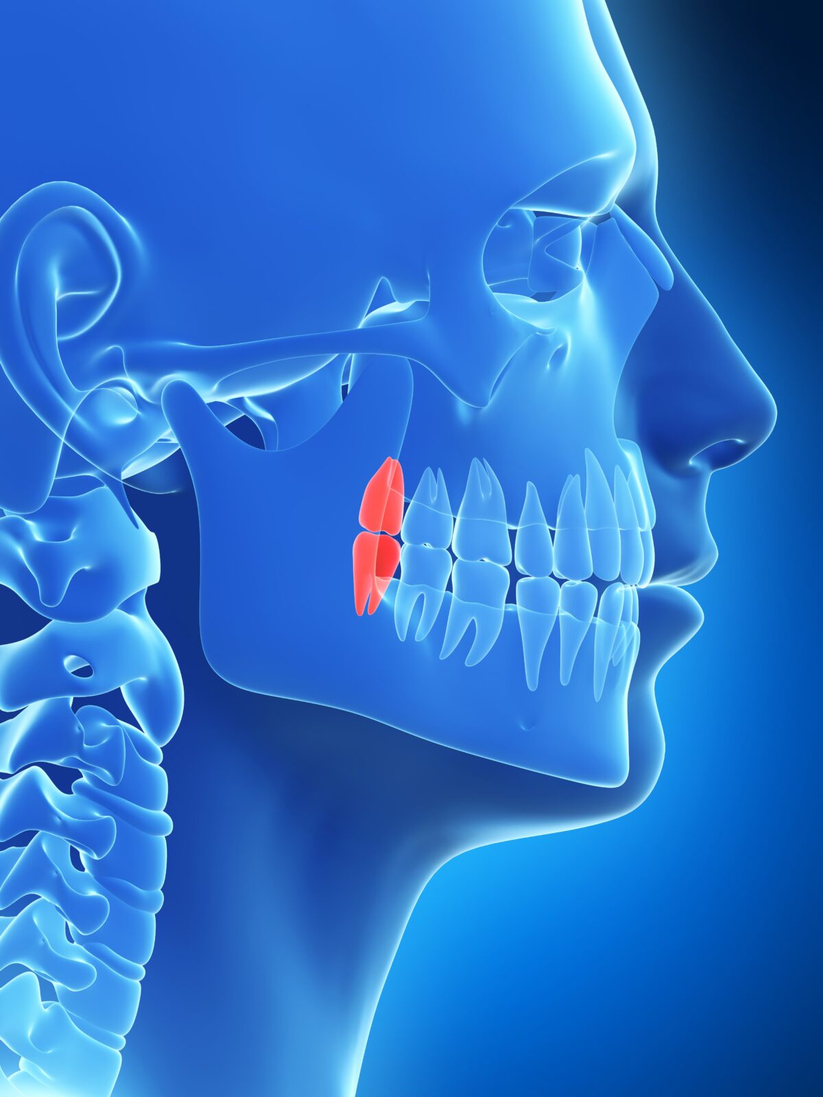 Are Your Wisdom Teeth Coming In? | Altoona, IA | Altoona Smiles