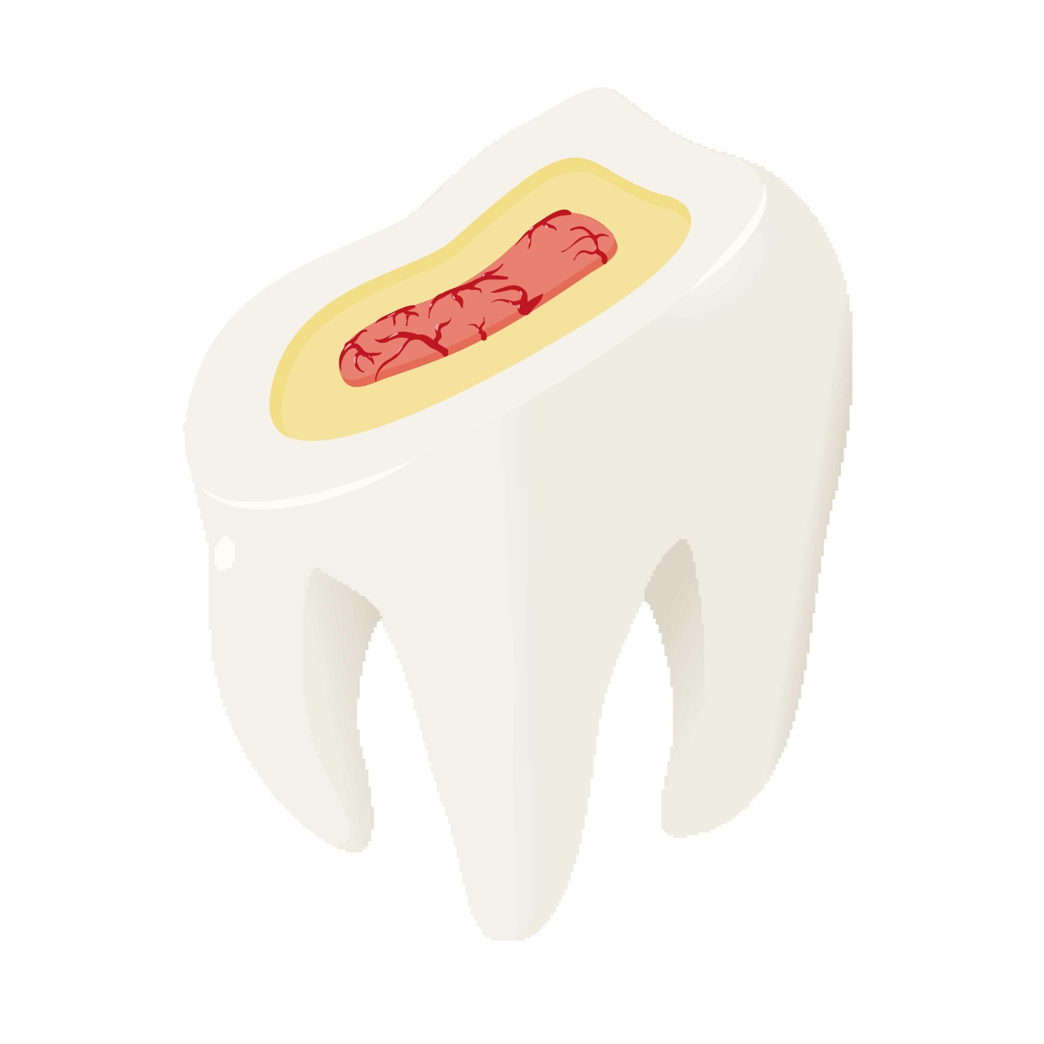 10 Reasons Your Teeth Are Yellow (And What To Do About It) | Altoona ...