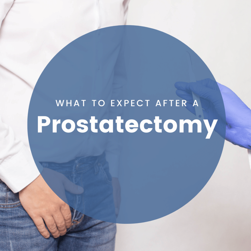 What to Expect After a Prostatectomy | New York City | 1 Prostate Center