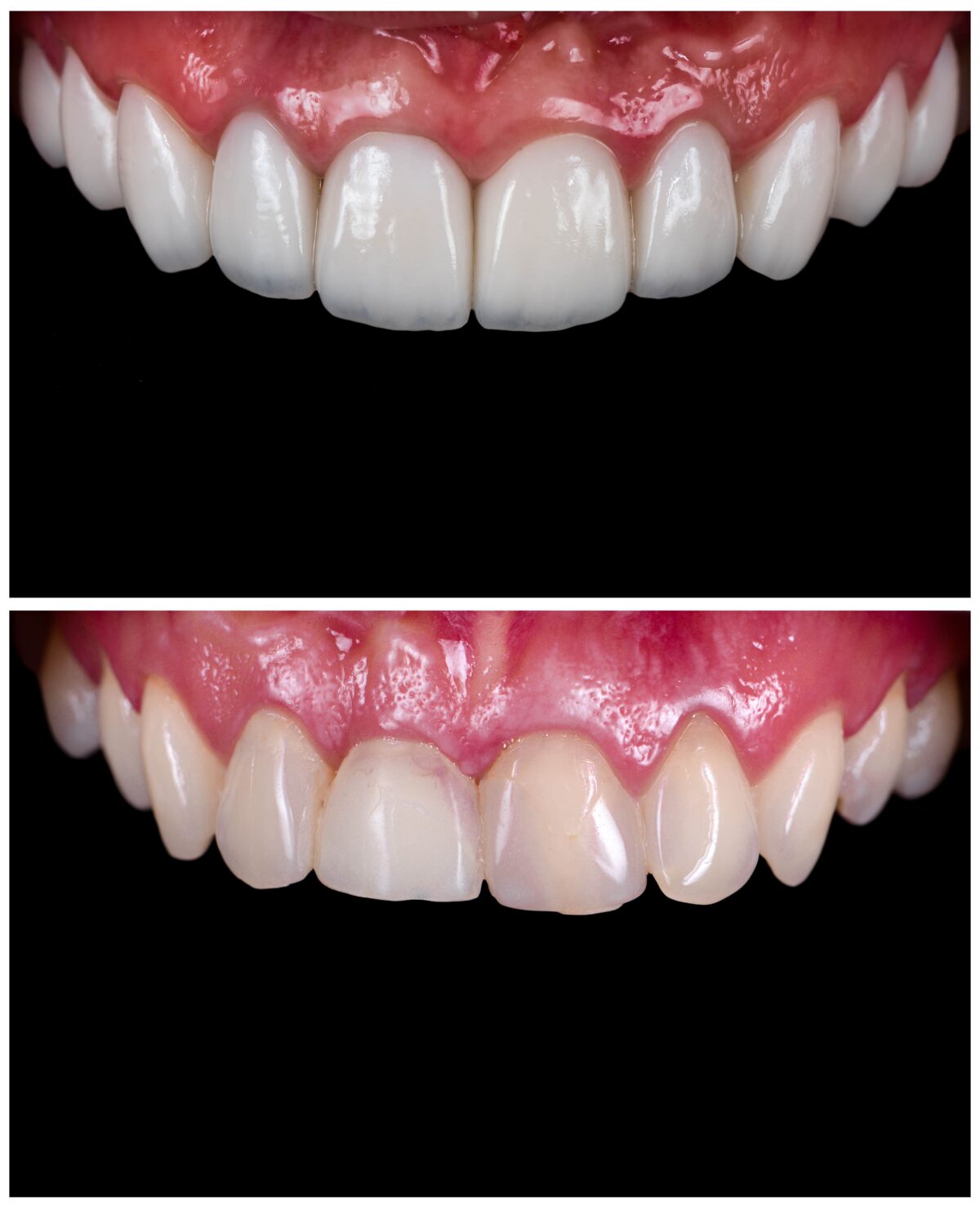 The Top 5 Most Commonly Asked Dental Questions (And Their Answers ...