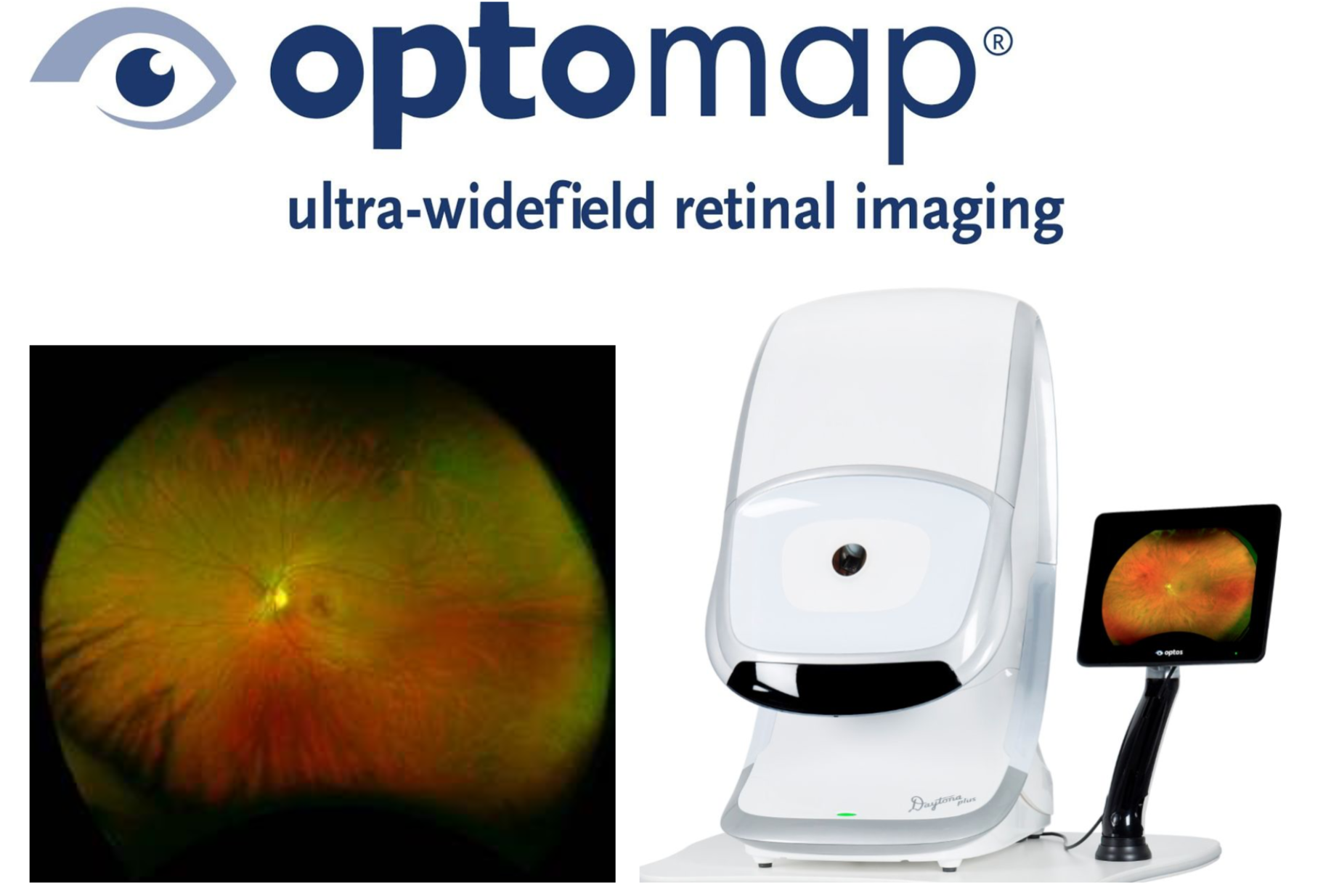 Optomap® Digital Retinal Imaging System | Winston Salem, NC | IdealEyes ...