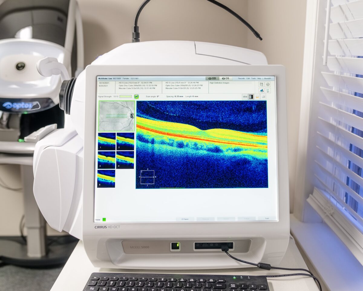 Optical Coherence Tomography (OCT) | Winston Salem, NC | IdealEyes ...